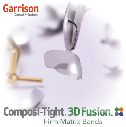 Composi-Tight® 3D Fusion™ Firm matrix bands launched by Garrison Dental ...