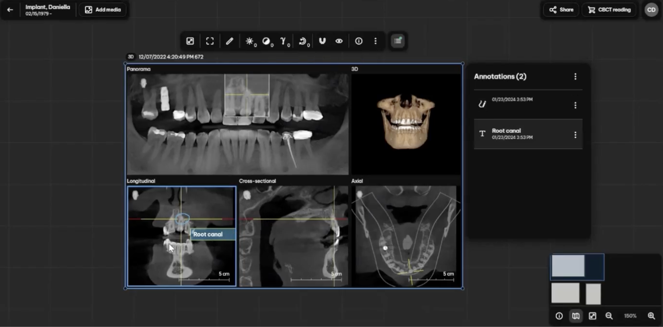 DS Core™: Upload of historical X-ray data from Sidexis® 4 software now available | Inside Dentistry