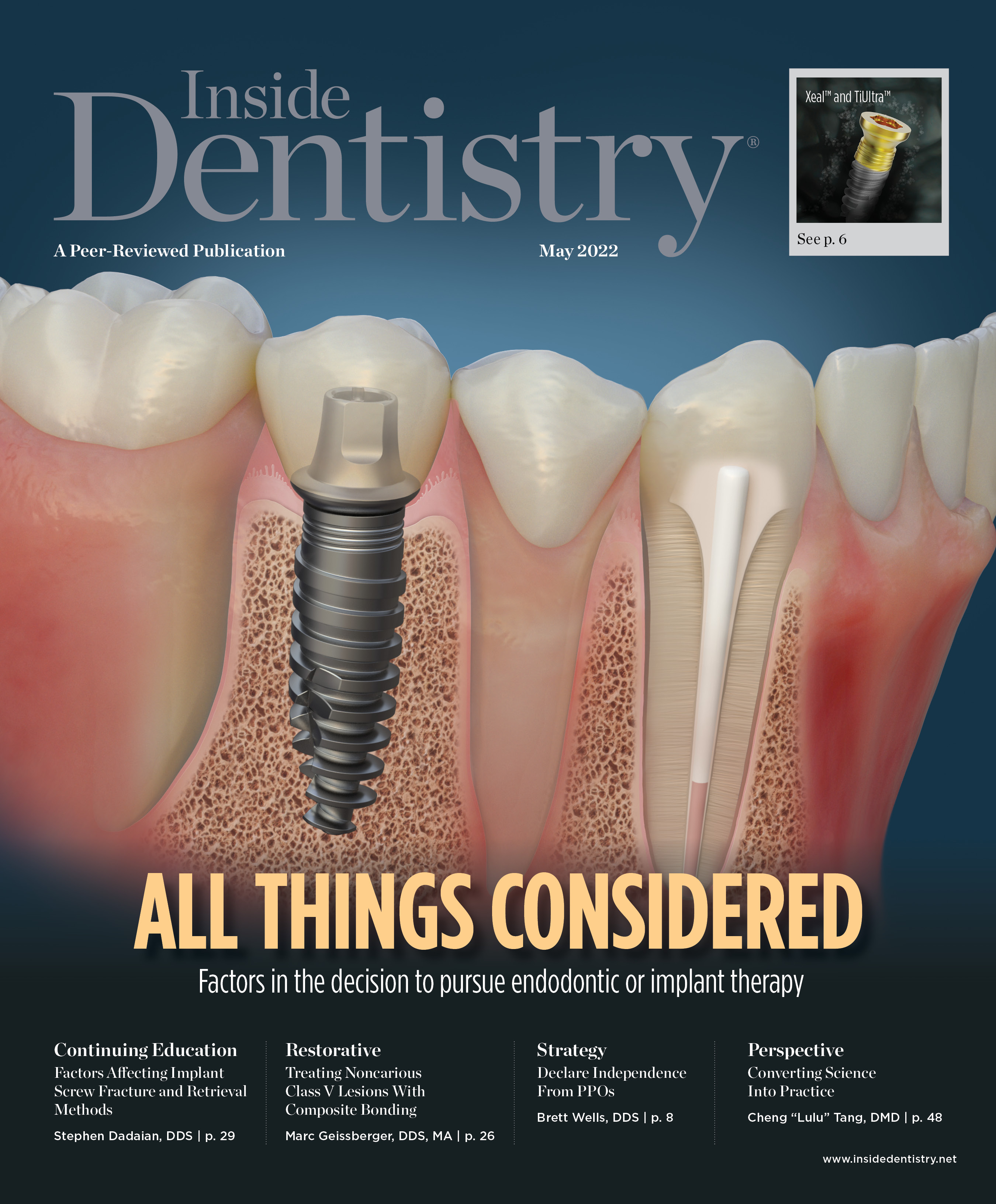 May 2022 | Inside Dentistry