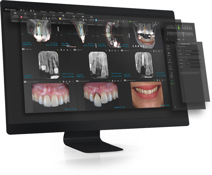 DTX Studio™ Clinic | Inside Dentistry