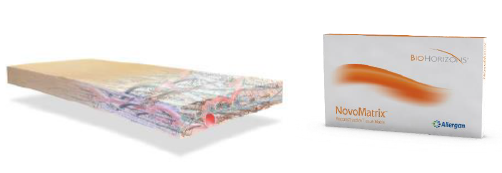 NovoMatrix™ – the next generation soft-tissue augmentation material ...
