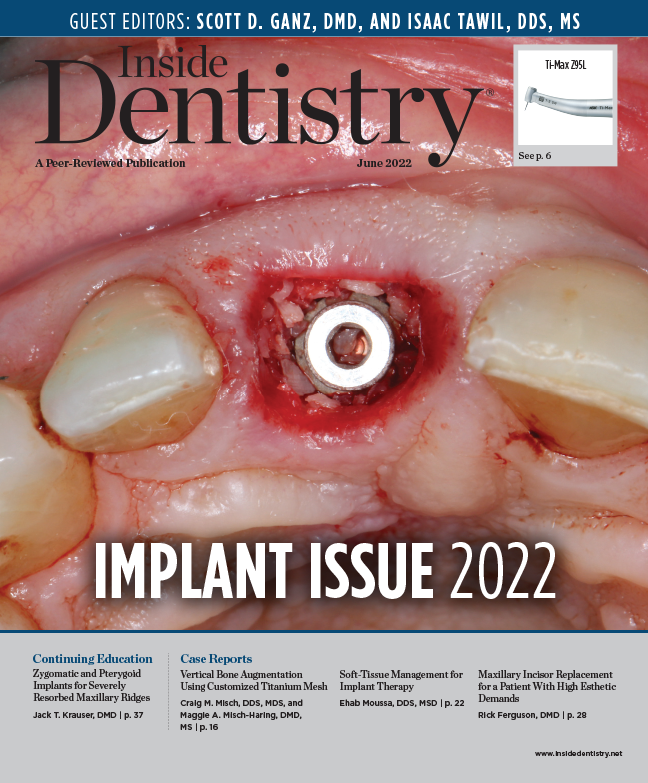 June 2022 | Inside Dentistry