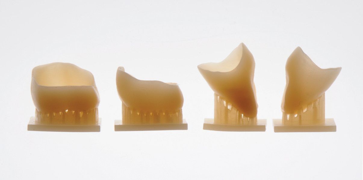 The Race for the Crown | Inside Dentistry