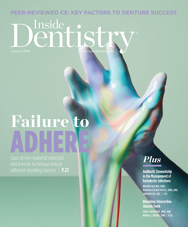 January 2018 | Inside Dentistry