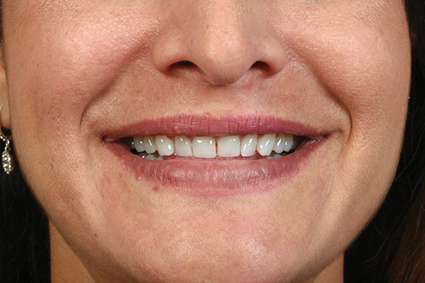 A Smile From Within | Inside Dentistry