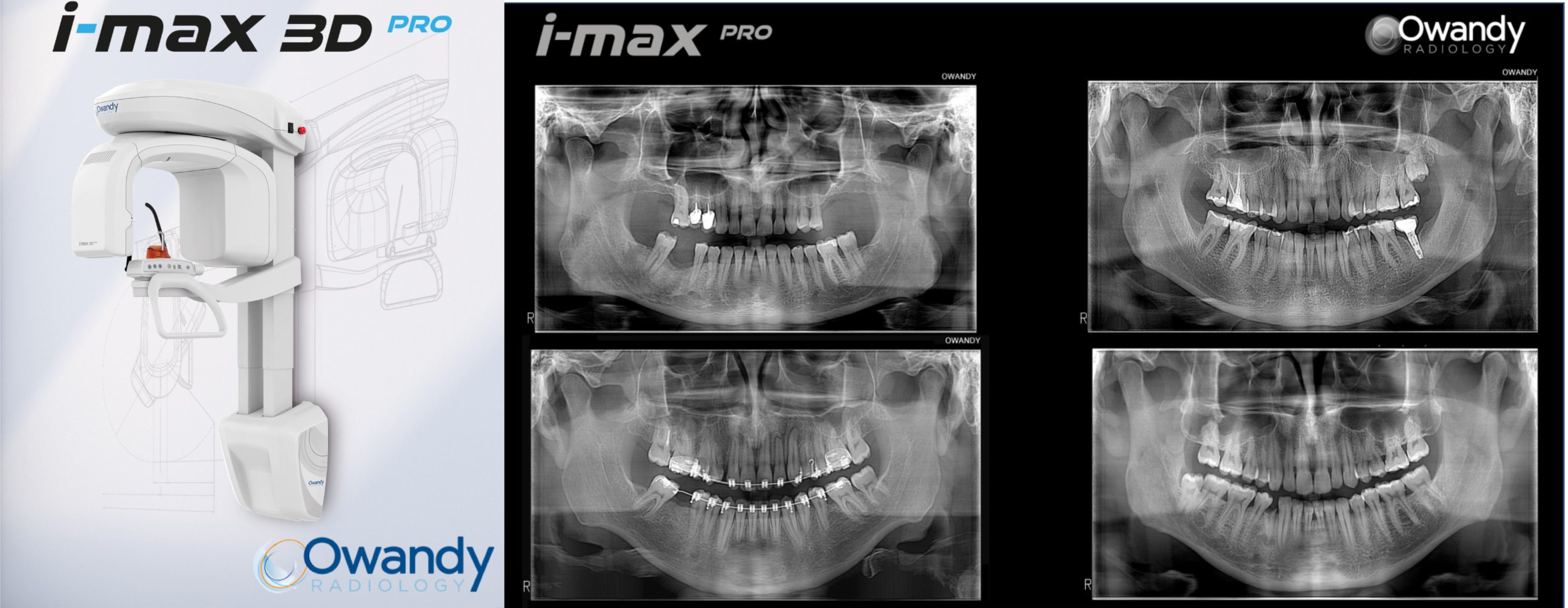 At CDA Spring 2023: Owandy Radiology Unveils the Next Generation I-Max ...