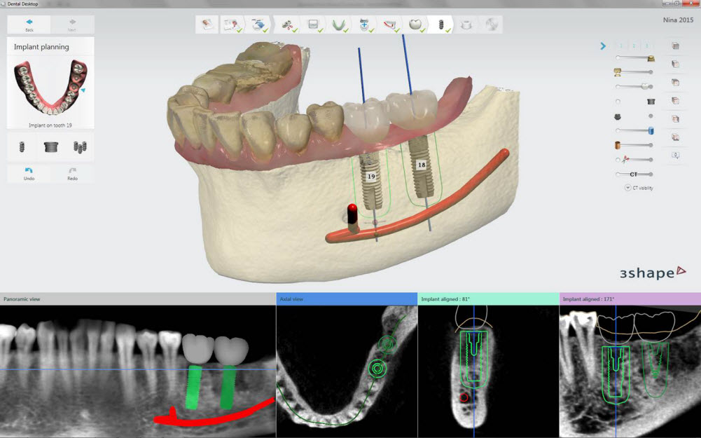 Implant Studio Adds DENTSPLY Implants | Inside Dentistry