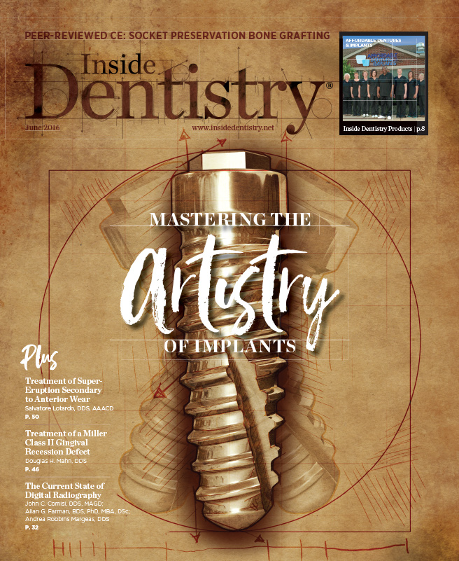 June 2016 | Inside Dentistry