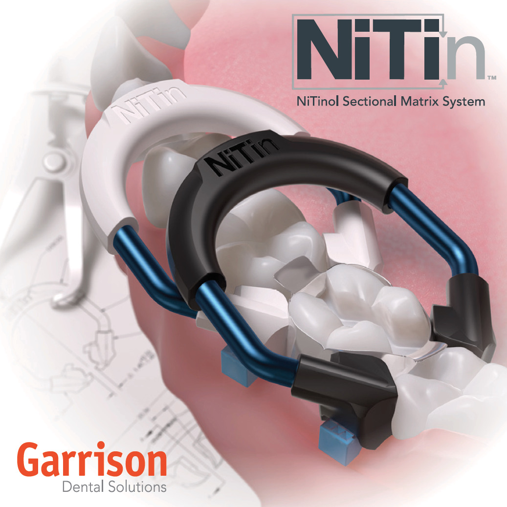 NiTin™ Sectional Matrix System Launched by Garrison Dental Solutions ...