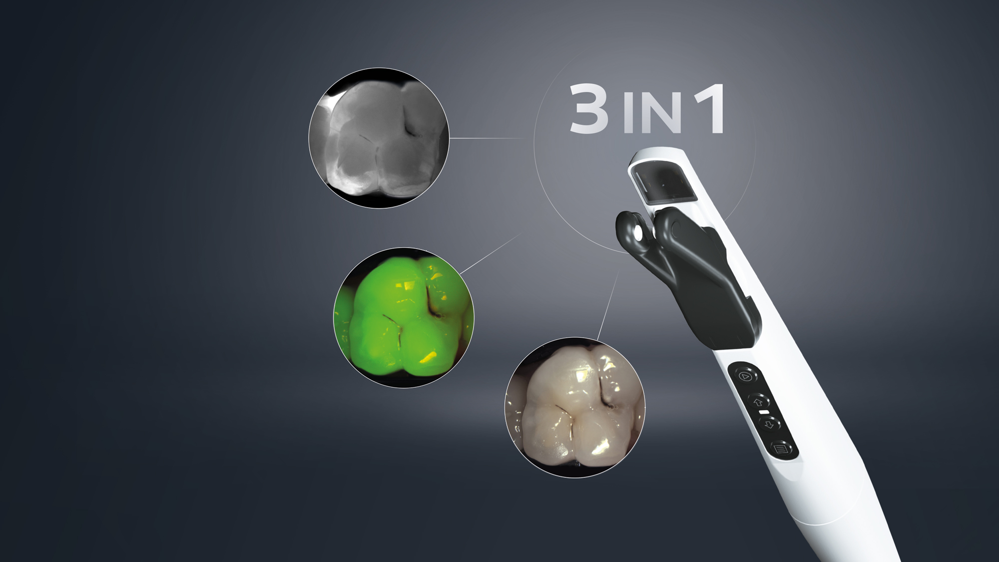 KaVo Introduces the Revolutionary DIAGNOcam™ Vision Full HD: Triple ...